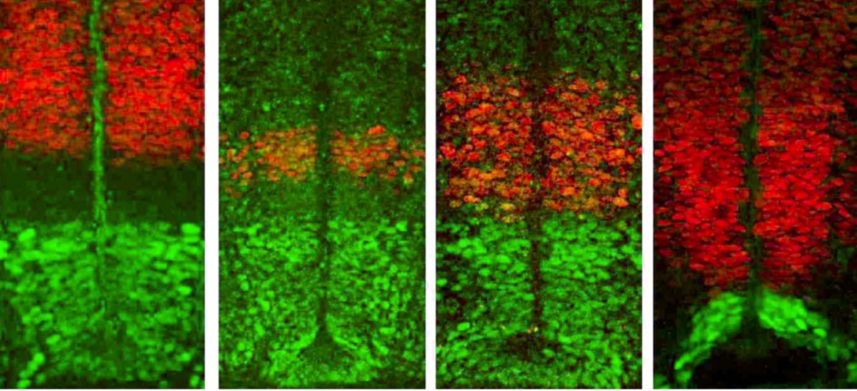 Overview – Briscoe Lab